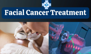 Advancements in Facial Cancer Diagnosis: Early Detection and Screening